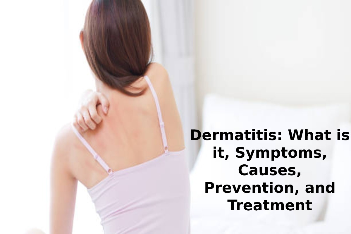 Dermatitis: What is it, Symptoms, Causes, Prevention, and Treatment